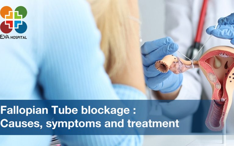 Fallopian Tube Blockage: Causes, Symptoms and Treatment - Eva Hospital