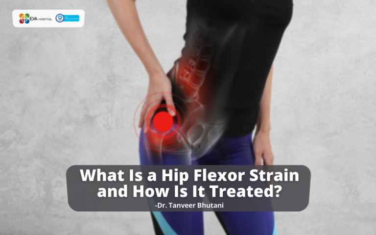 What Is a Hip Flexor Strain and How Is It Treated?